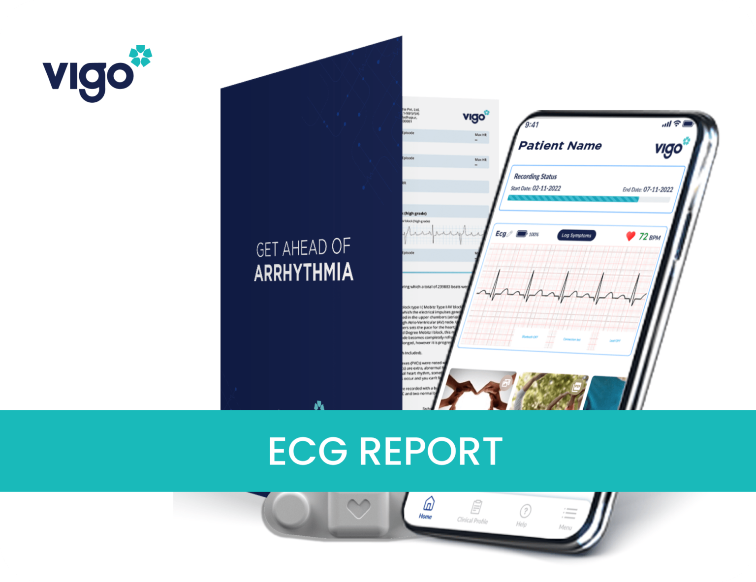 What is my ECG report? – Vigo Buddy – Here for you