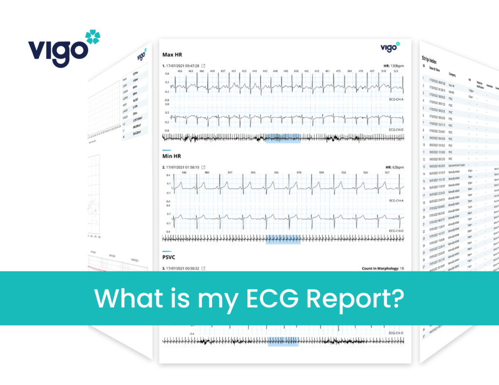 ECG Report you can trust – Vigo Buddy – Here for you